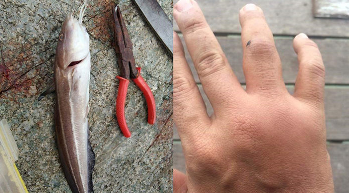 Siapa Pernah Kena Sengat Sembilang Karang?